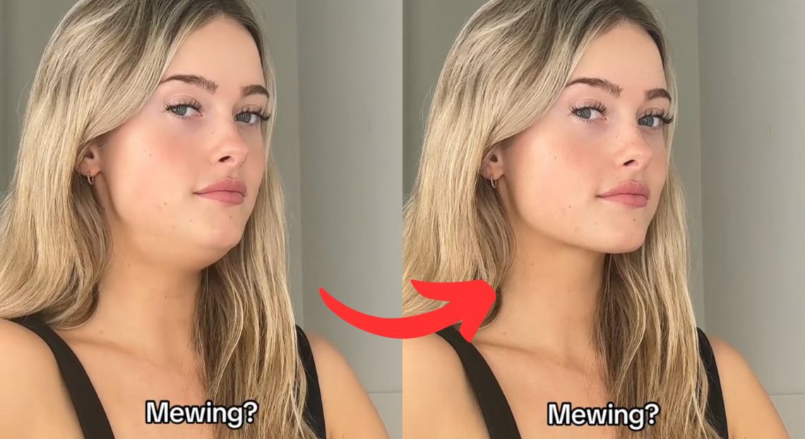 'Mewing' is the latest TikTok beauty hack people are doing for flawless ...