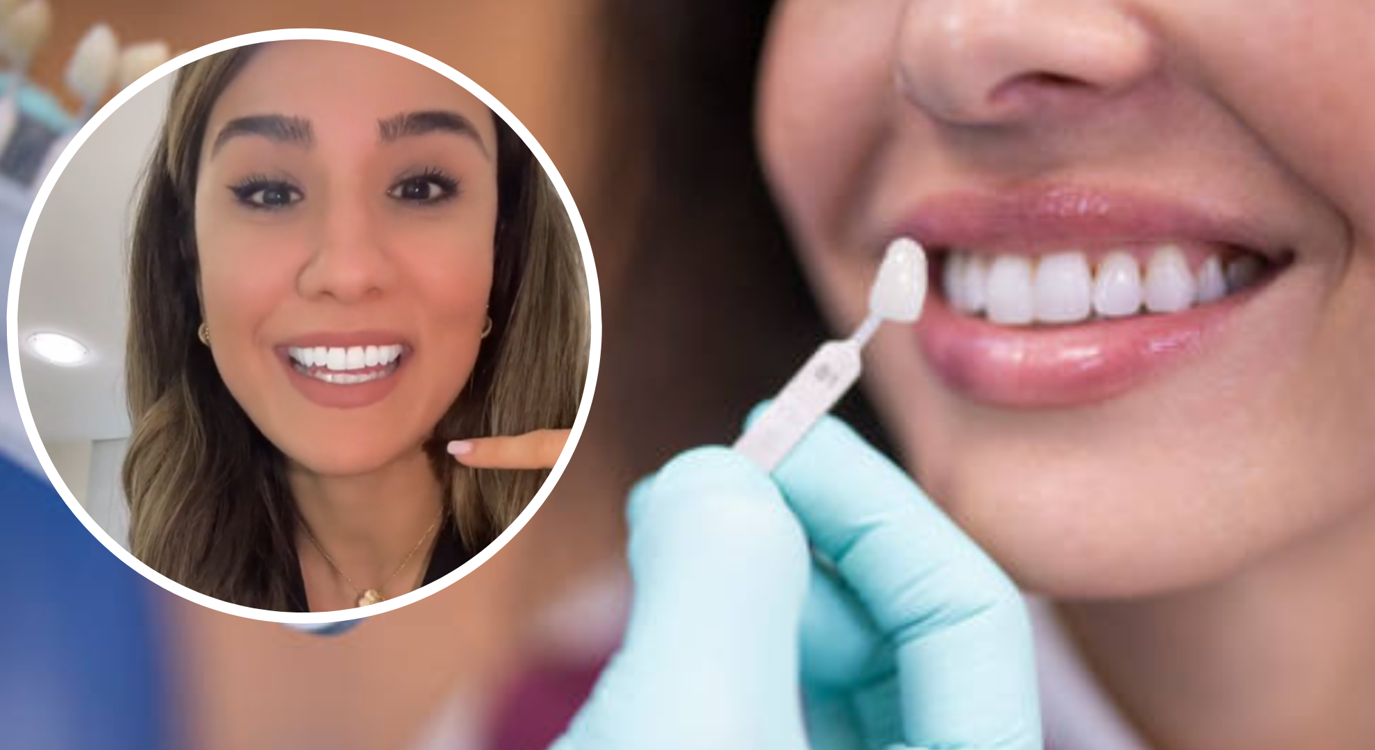 Dentist reveals simple trick to find out if you need teeth whitening or not