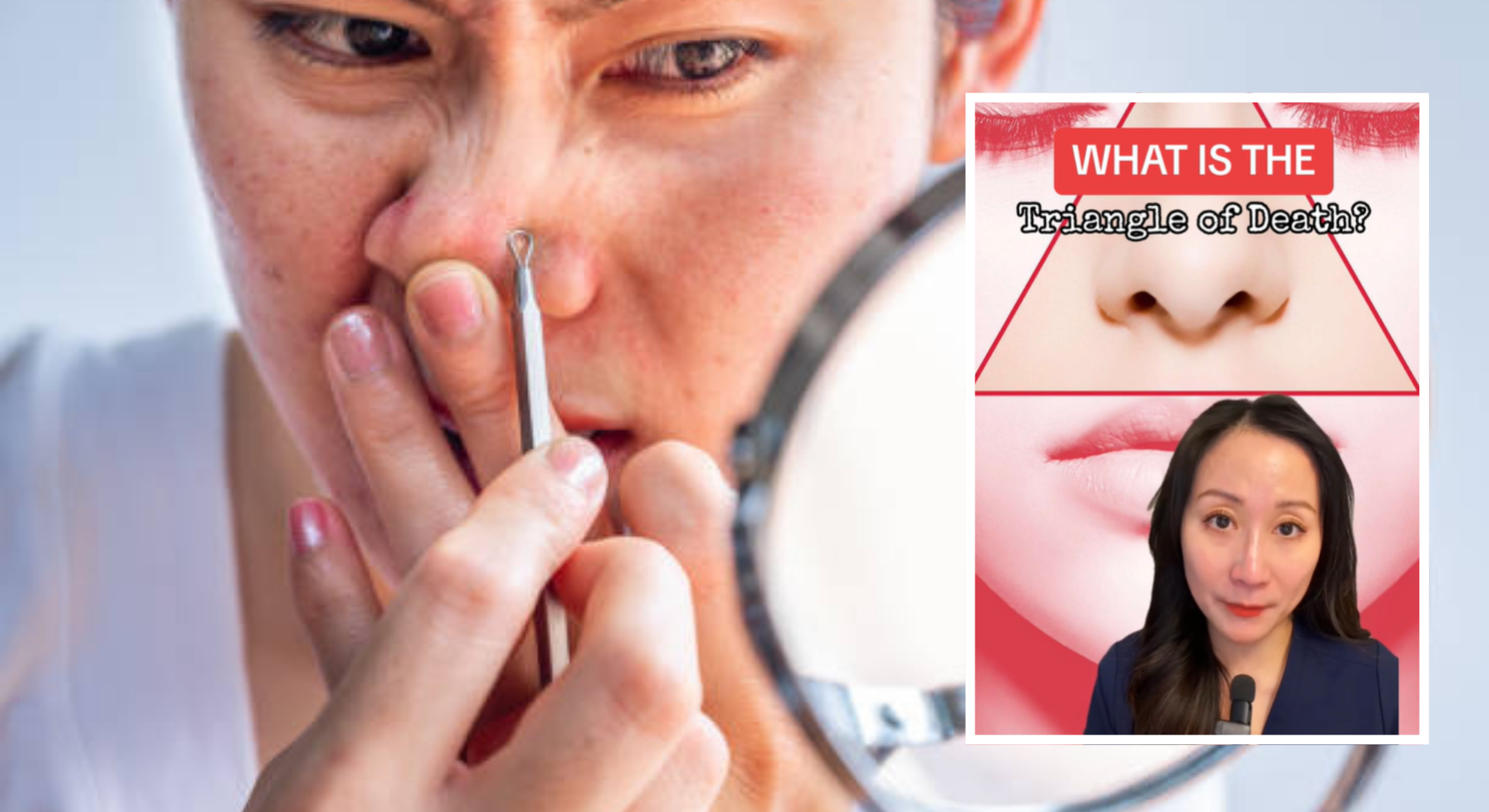 Skincare expert warns against popping pimples around the nose, also ...