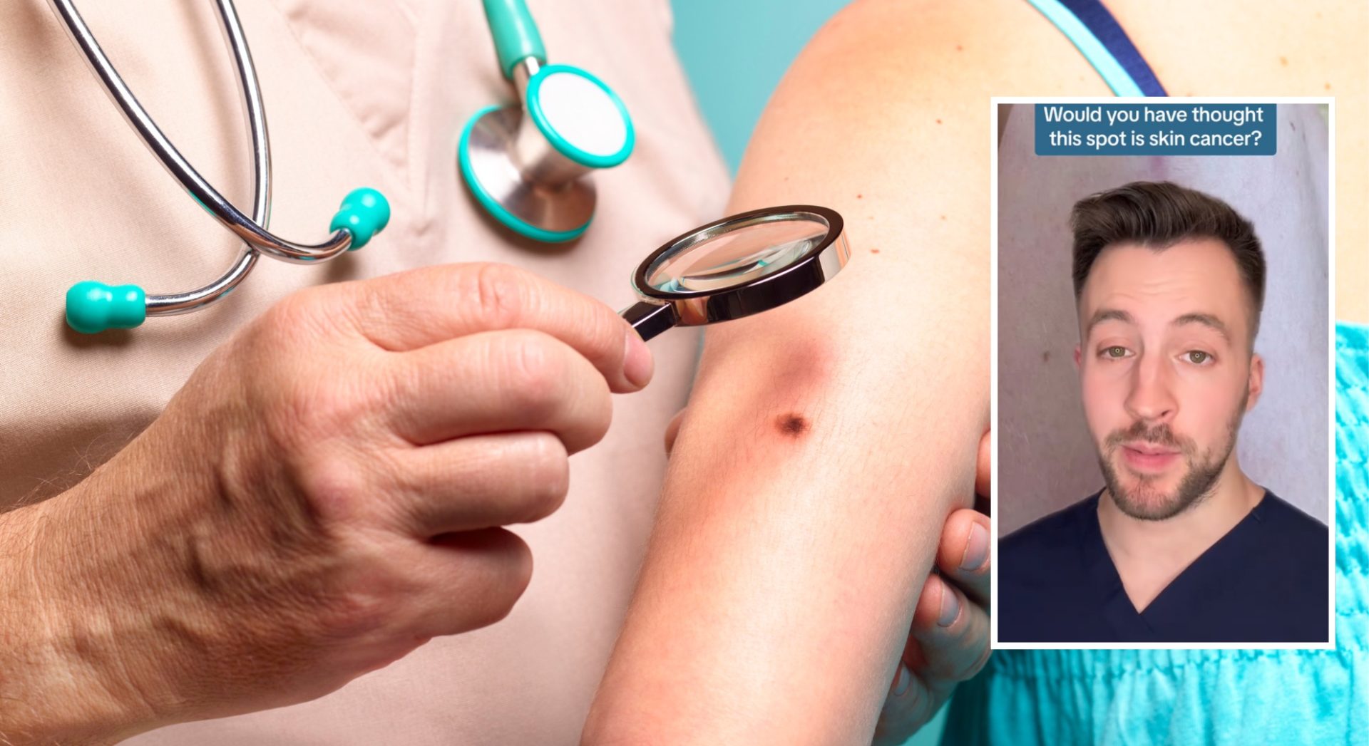 Dermatologist highlights one rare skin cancer symptom you need to be ...