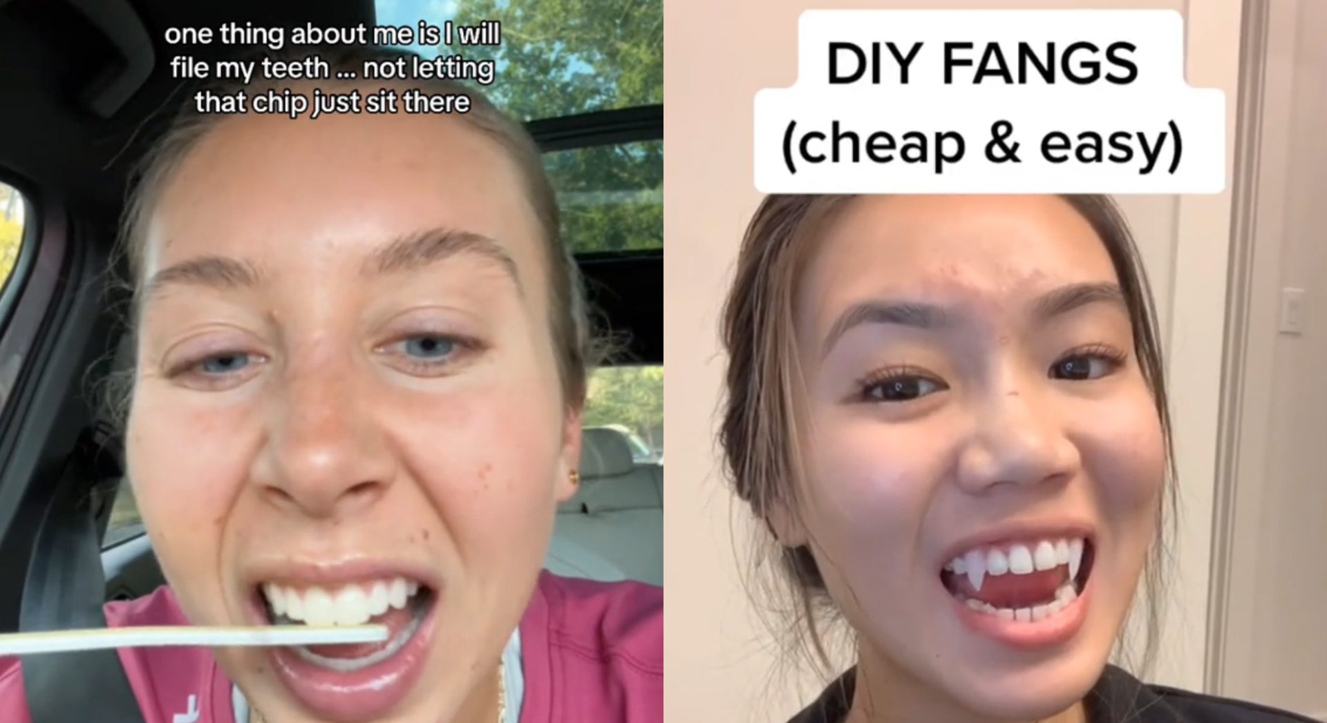 Dentist warns against dangerous teeth trends that could cause ...