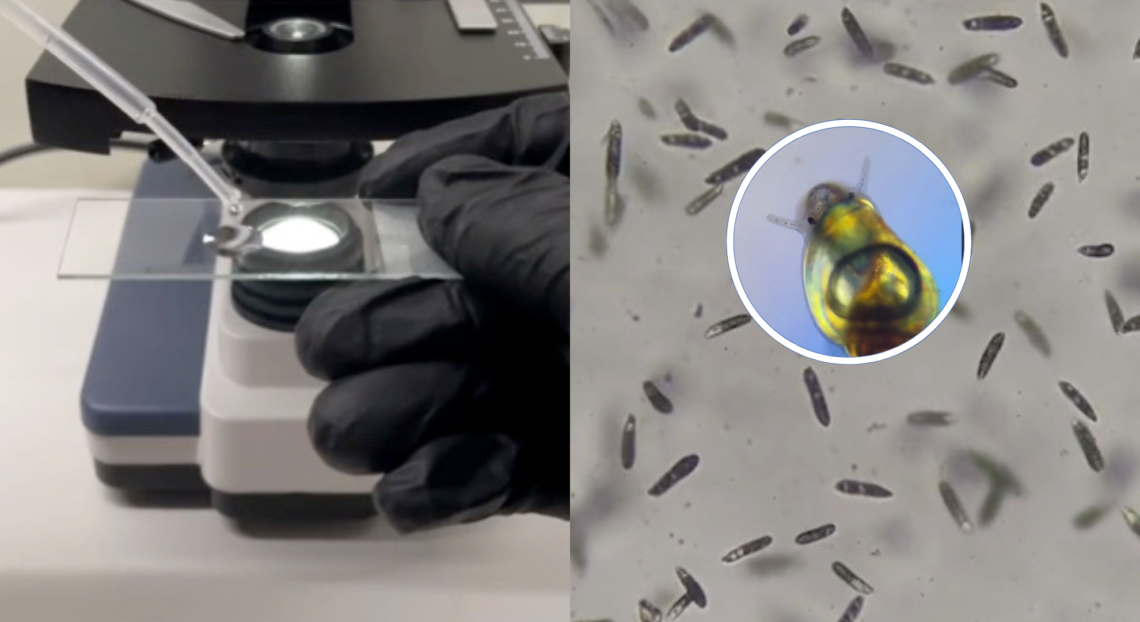 People 'never want to drink tap water again' after seeing it under a ...