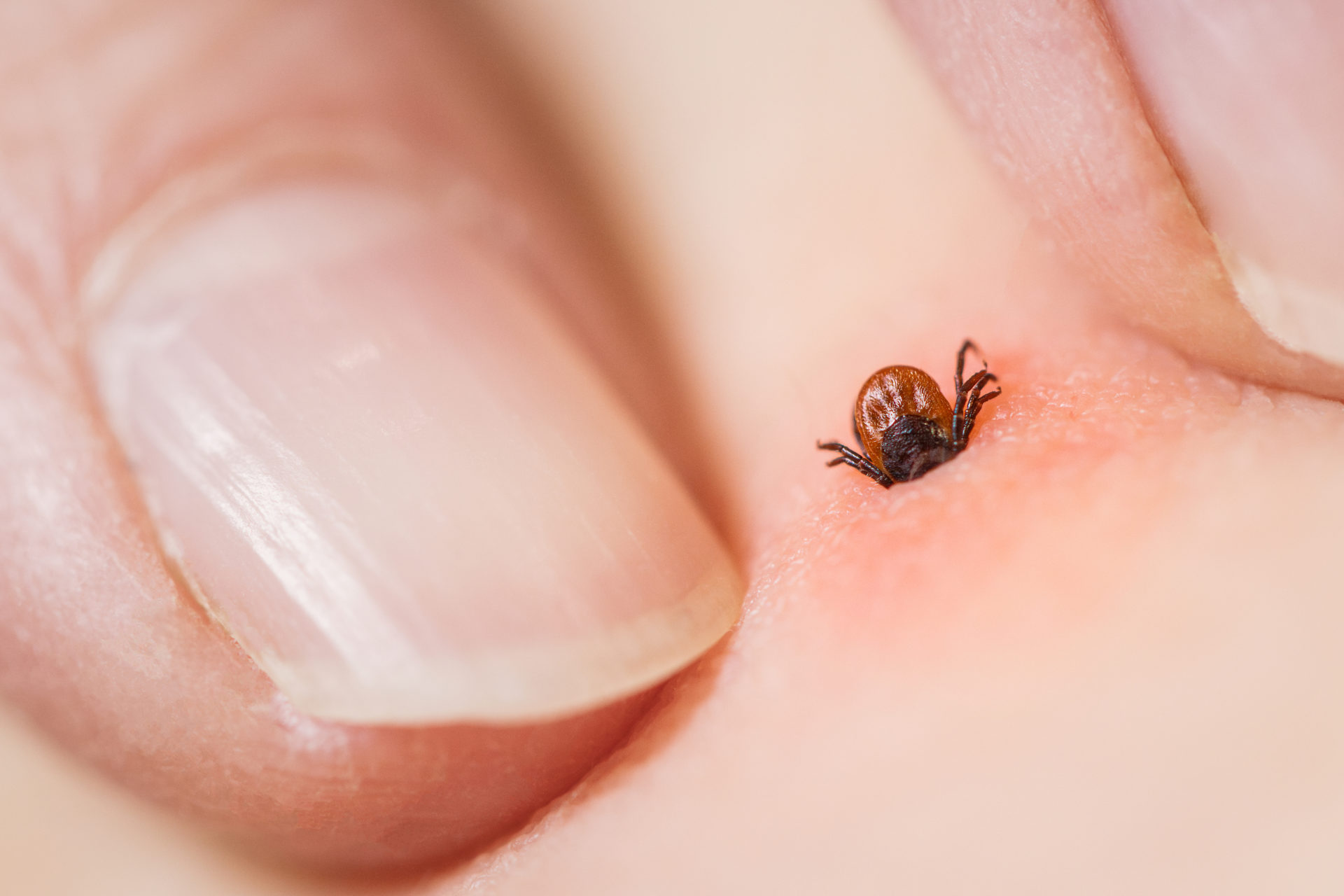 'First stage' of Lyme disease you definitely shouldn't ignore after a ...