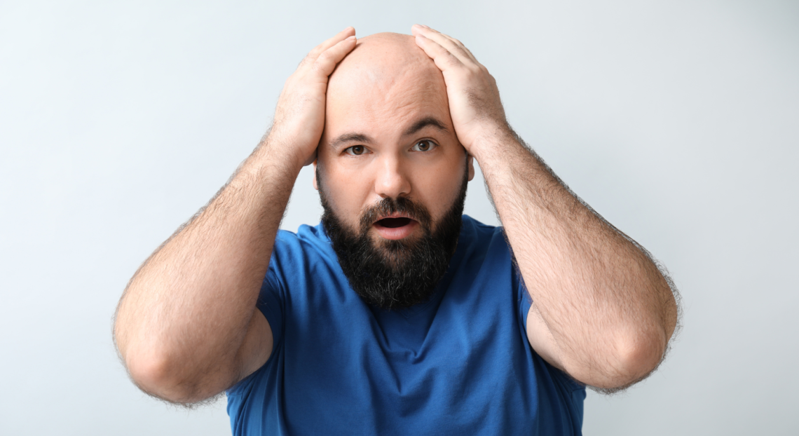 Scientists discover a ‘natural sugar’ that can treat male baldness