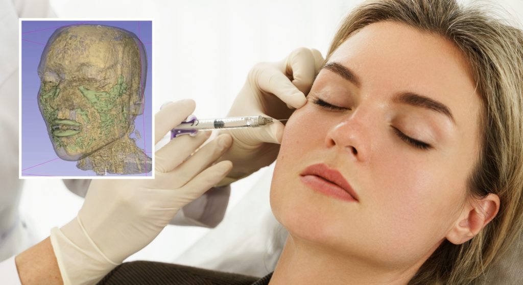 Video of face filler under MRI scanner is putting people off the ...