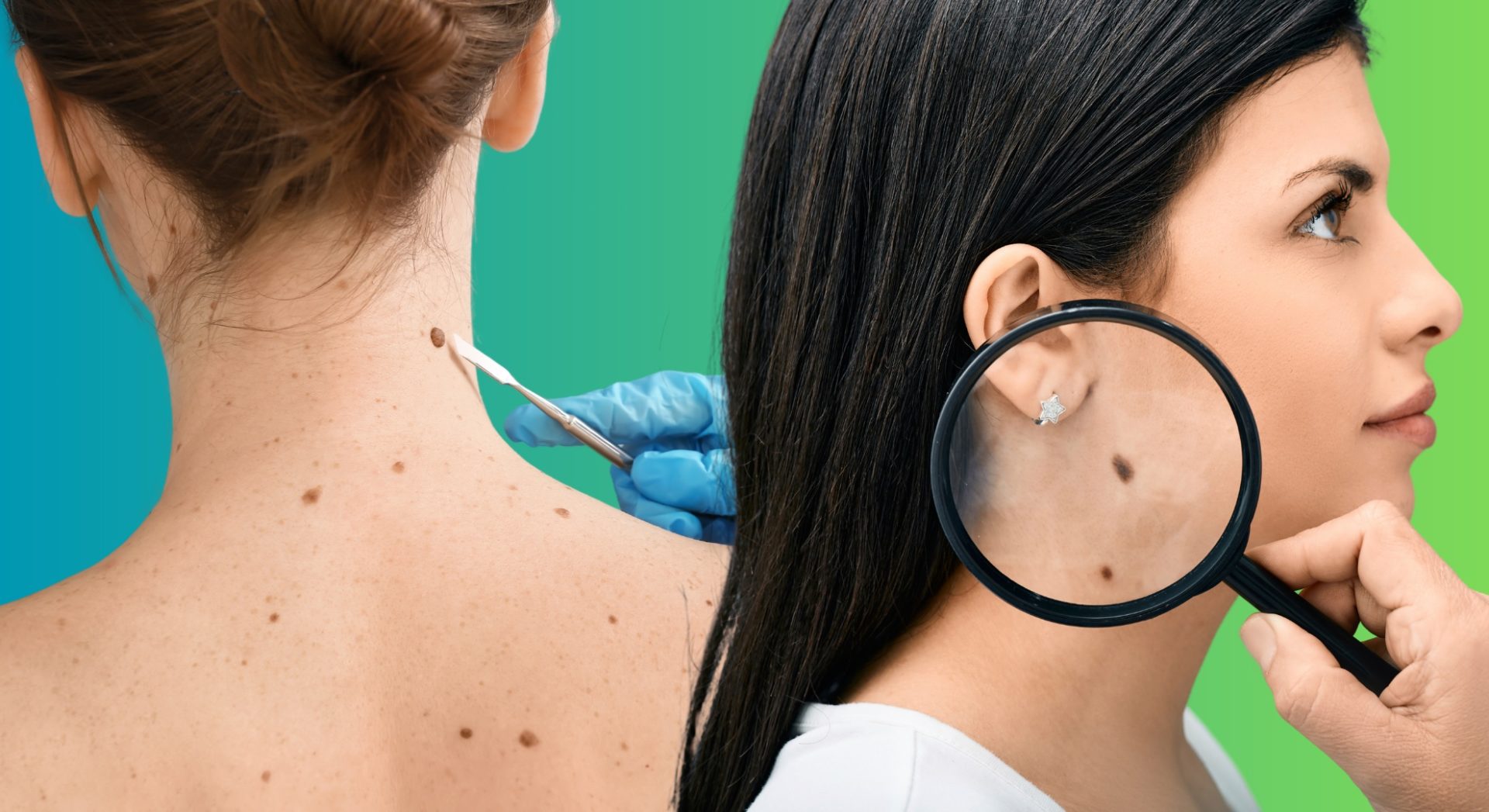 3 common skin cancer signs that will help you 'catch it early ...