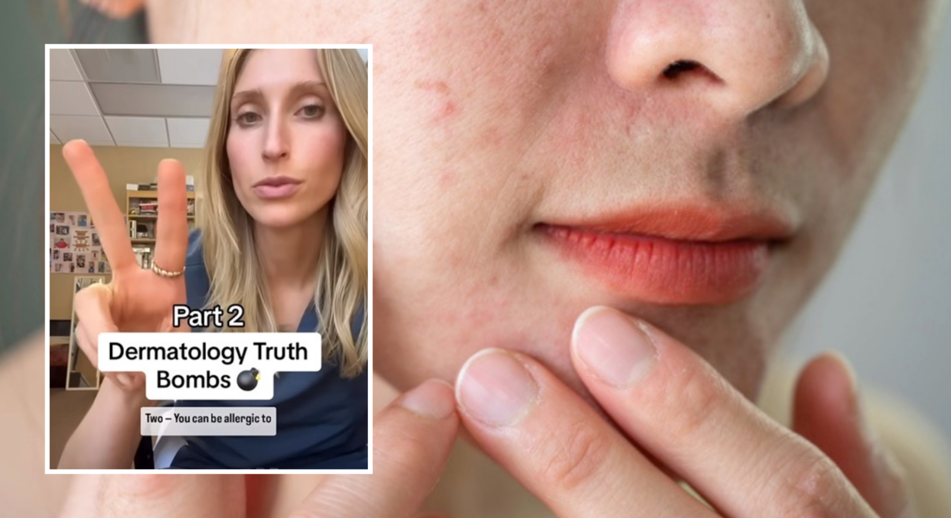 Dermatologist says people can get temporary 'sensitive skin' from their ...