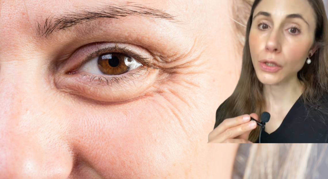 Dermatologist ‘reduces appearance of eye wrinkles’ in 2 days by ...