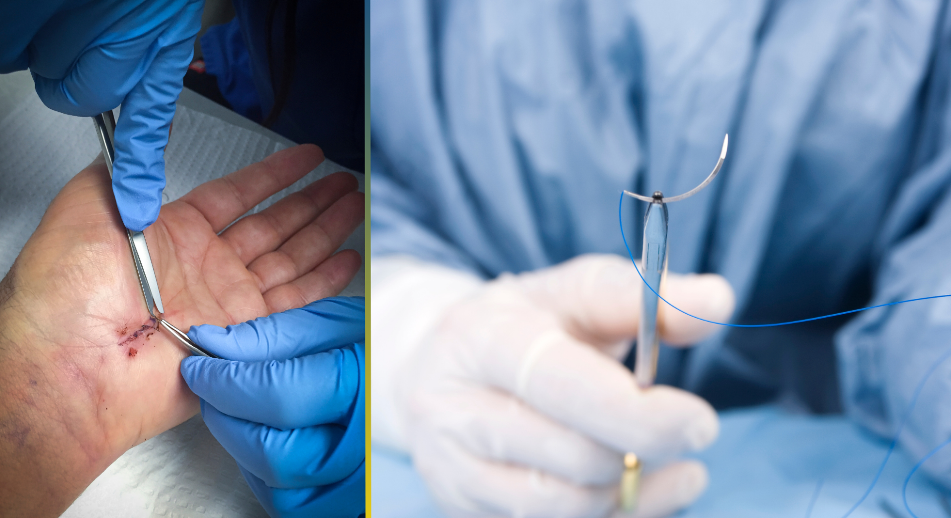 Your doctor could soon be sewing you up with spider silk after ...