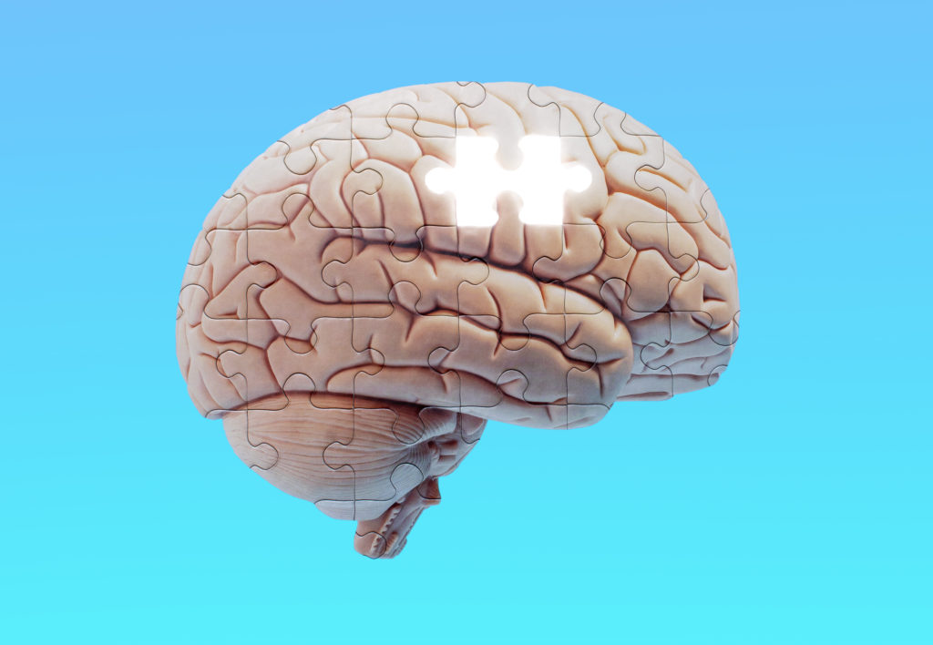 Alzheimer’s disease damages the brain in two phases but they have ...