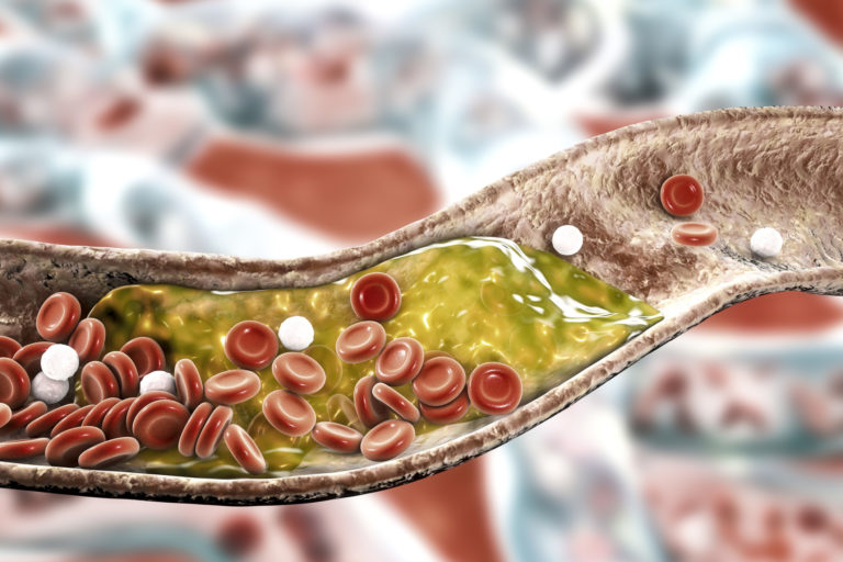 After 13 years, scientists discover best way to 'reverse' cholesterol ...