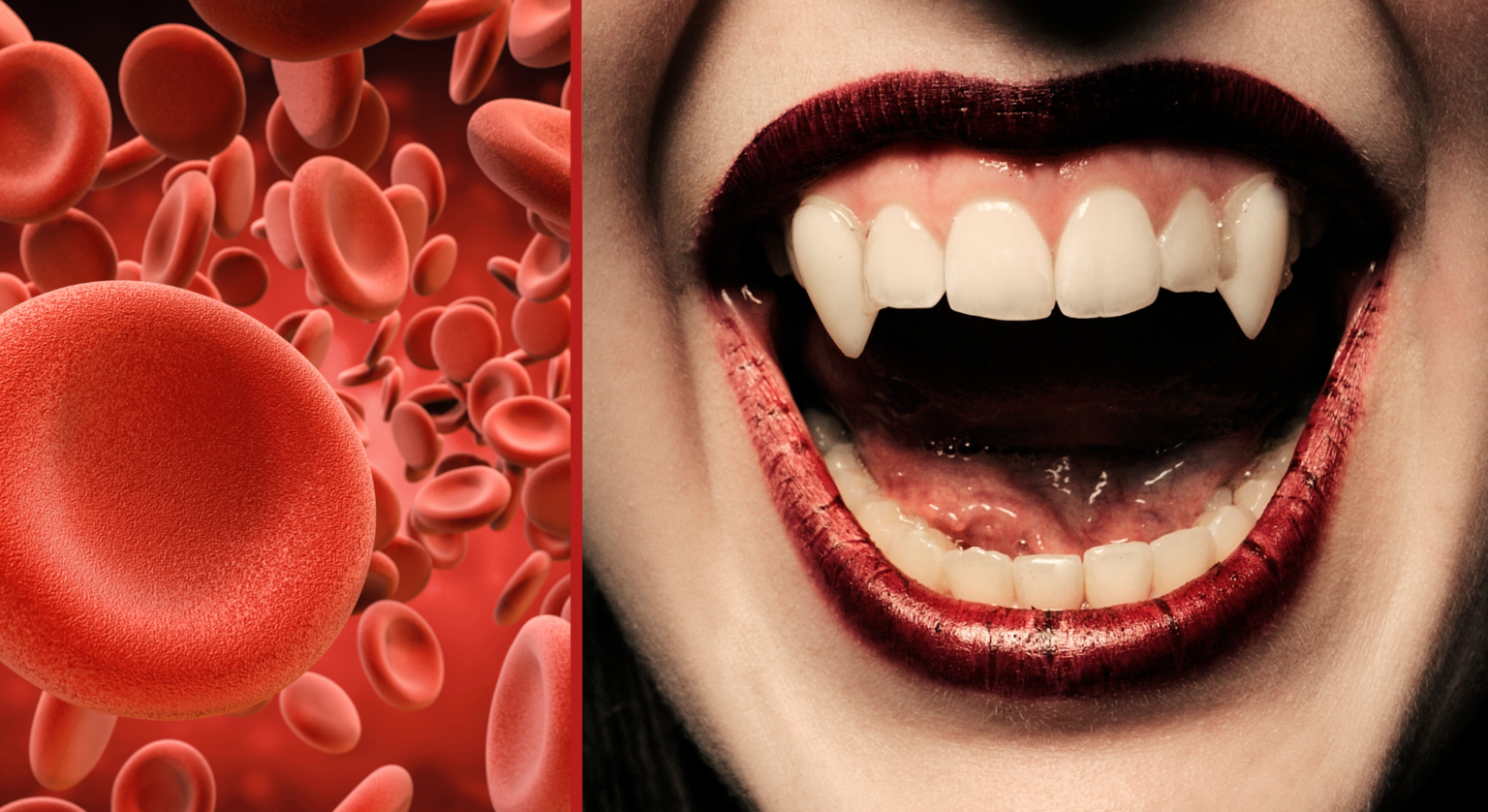 Real life ‘Dracula disease’ can result in vomiting, hallucinations, and ...