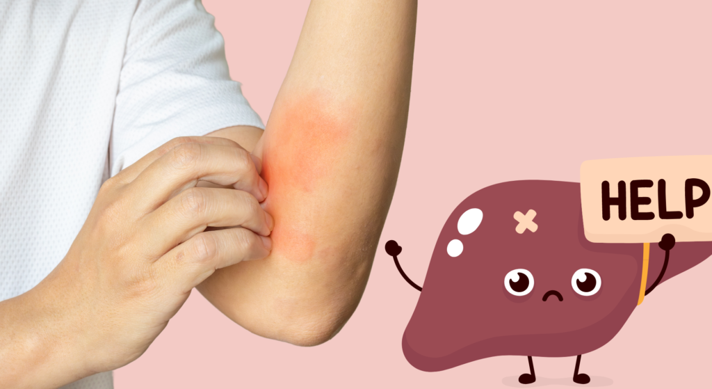 Dermatologist breaks down 7 signs of liver damage that appear on the skin