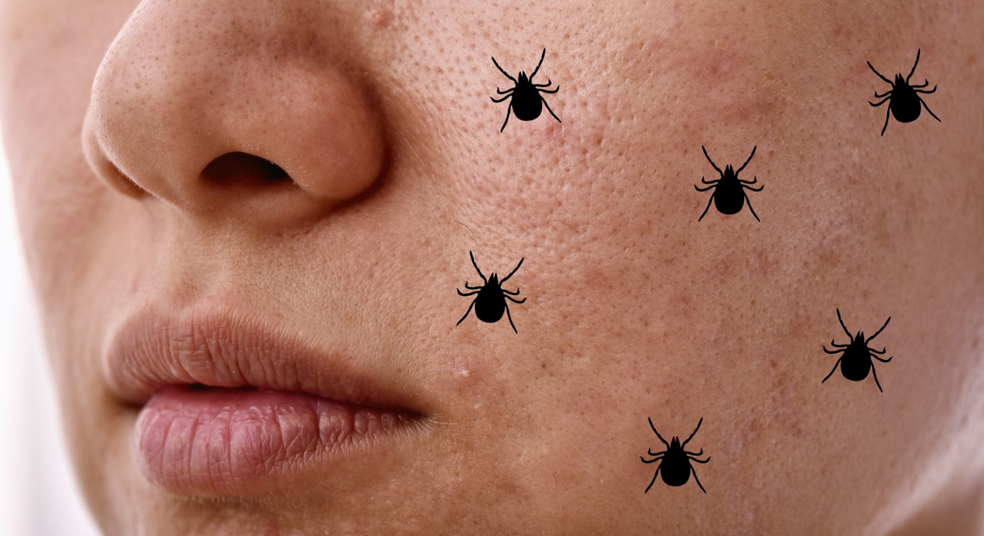 Tiny bugs are living on your face, and there's nothing you can do about it